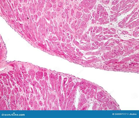 Human Heart Endocardium Stock Image Image Of Heart 243597117