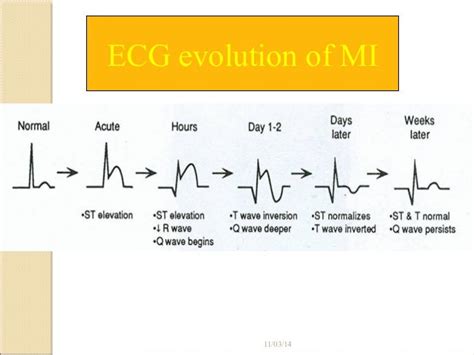 Ecg Basics