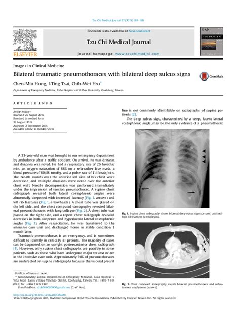 Pdf Bilateral Traumatic Pneumothoraces With Bilateral Deep Sulcus Signs