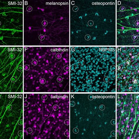 Immunomarkers For Iprgc Sonɑ Cell Type Classification Maximum