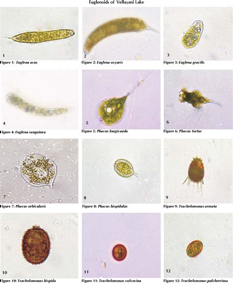 Figure 1 From Species Diversity Of Euglenoids In Vellayani Lake Of