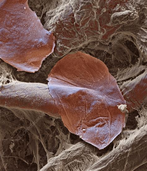 Cells From Gingival Sulcus Sem Stock Image C0578573 Science