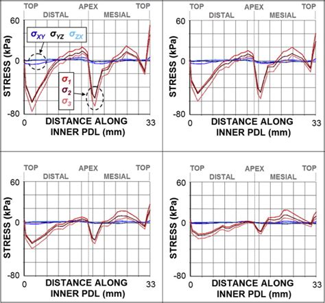 Three Dimensional Modeling And Finite Element Analysis In Treatment