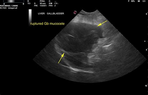 Ruptured Gallbladder Mucocele With Bile Peritonitis In An 8 Year Old Fs