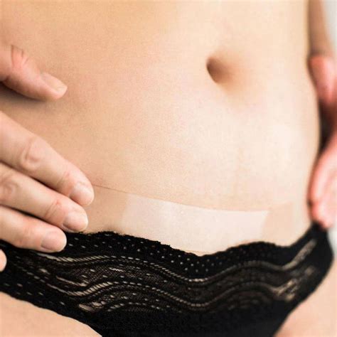 Tummy Tuck Scar Heal Kit Best Results
