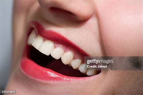 Red Lips Smile Teeth Photos And Premium High Res Pictures Getty Images