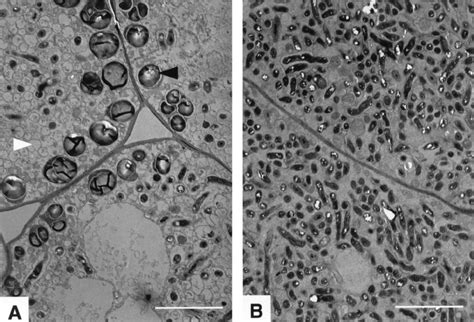 Electron Micrographs Showing The Structure Of Soybean Nodule Cells