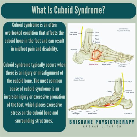 What Is A Cuboid