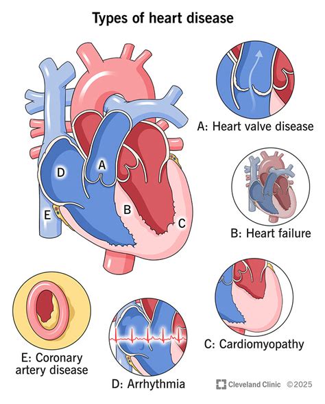 Understanding The Top Cardiac Problems Affecting Many People Today