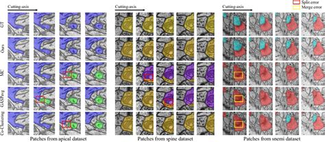 Qualitative Comparison Of The Neuron Reconstruction Performance From