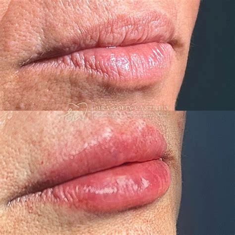 Dra Sofia Castilho Dentista Poá E Suzano Drasofiacastilho