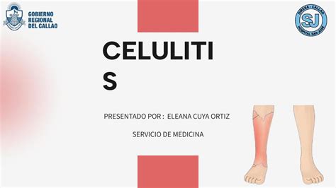 Celulitis Infecciosa Eleana Norma Cuya Ortiz Udocz