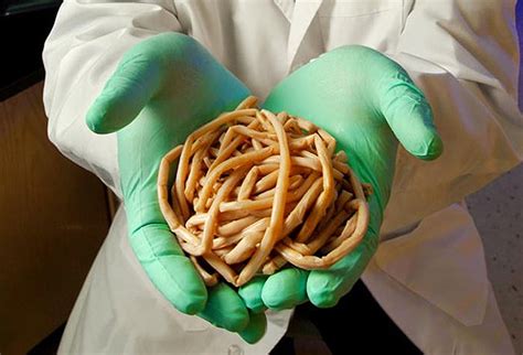 Intestinal Worms In Stool