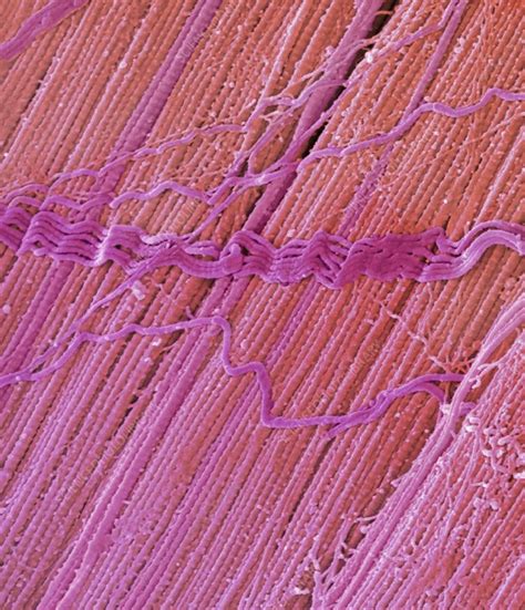 Tendon Sem Stock Image F0302305 Science Photo Library