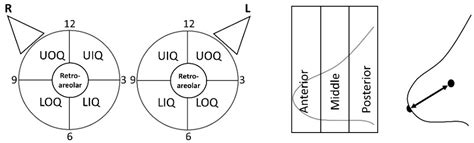 Where Is 10 O Clock Position On Breast At Byron Wells Blog
