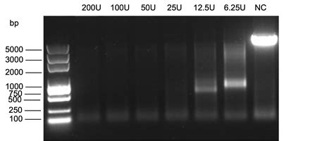 Exonuclease Iii Exo Ee101 Kactus