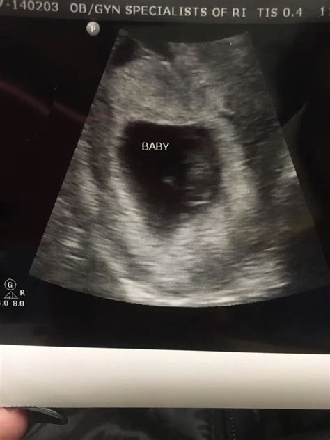 Today Was My Due Date Scrolller