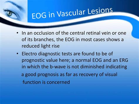Electrooculogram Eog Ppsx