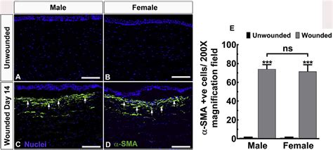 Is Sex A Biological Variable In Corneal Wound Healing Pmc