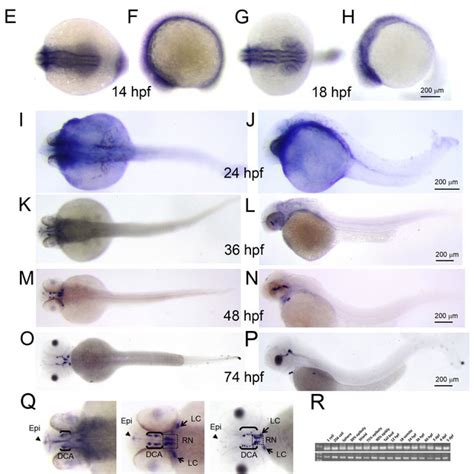 Ddc Expression Pattern In Zebrafish Ddc Mrna Was Expressed From