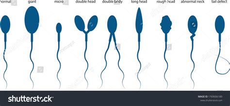 What Is Irregular Sperm Shape at Catherine Dorsey blog