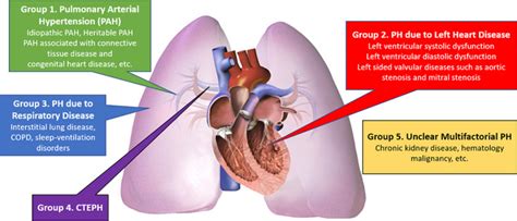 Pulmonary Hypertension In Remote And Disadvantaged Population