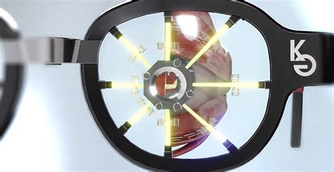 These Special Eyeglasses By A Japanese Startup Can Cure Myopia Or