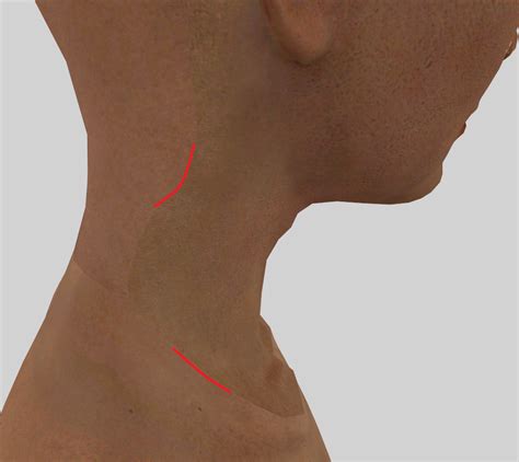 Neck Seam Fg 175 Fallout 4 Technical Support Loverslab