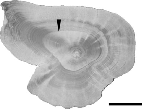 The Otolith Microstructure Of Spicomacrurus Kuronumai Showed A Distinct