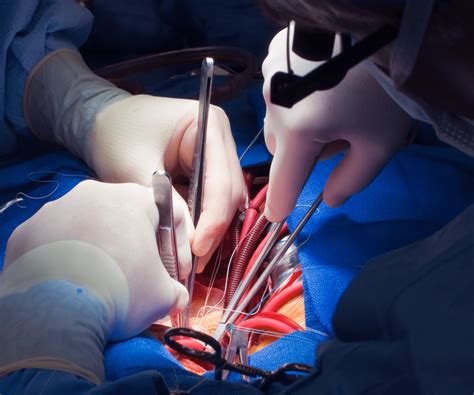 Cardiac Surgery Ayushman Heart Care Center