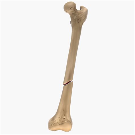 fracture 3d models download free3d