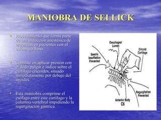 Anatomia Y Manejo De La Via Aerea Dificil En Pacientes Criticos Dentro