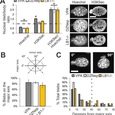 Alterations Of Chromatin Based Nuclear Rigidity Affect Nuclear Blebbing Download Scientific