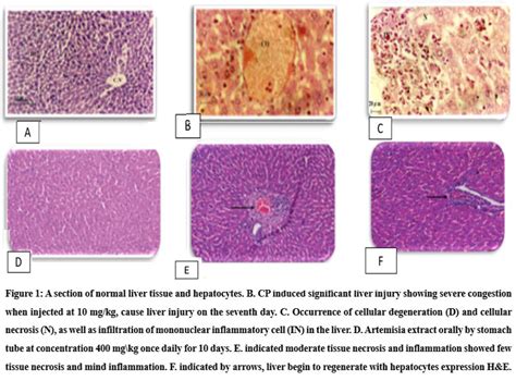 Effect Of Artemisia Vulgaris On Liver Of Albino Mice Exposed To Cisplatin Biomedical And