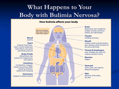 Ppt Fad Diets And Eating Disorders Powerpoint Presentation Free
