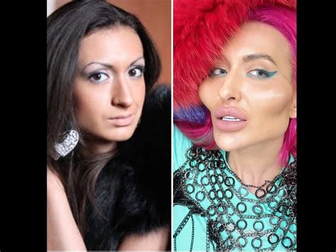 Model With Worlds Biggest Cheeks Shares What She Looked Like Before
