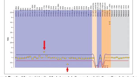 Pdf Atypical Hus Associated With Cfhcfhr 1 Hybrid Gene Semantic