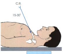 Ap And Ap Axial Projection Clavicle Radtechonduty