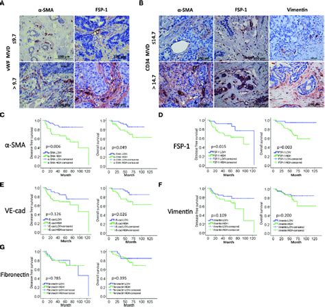Mvd Level Is Positively Correlated With Endmt Markers In Breast Cancer
