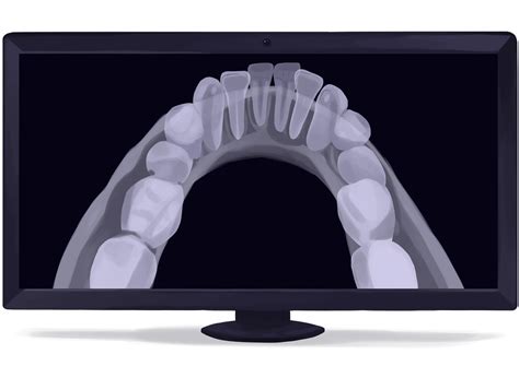 Occlusal Dental X Ray Digital Technical Picture Picture By Flickr