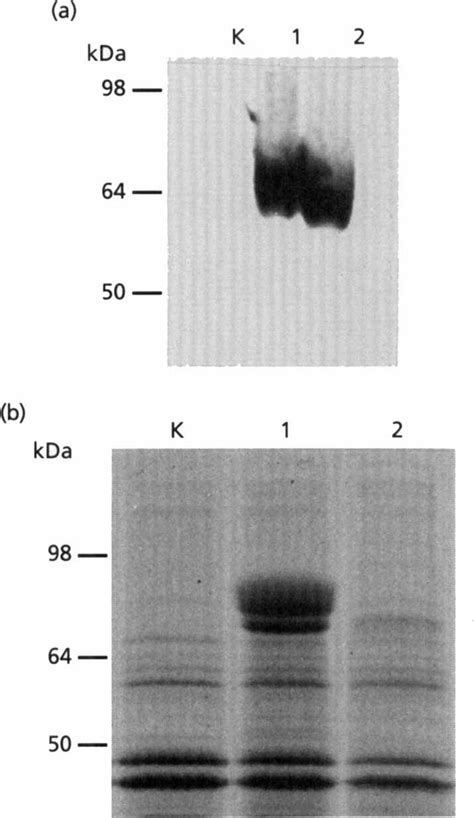 Chitinase Activity And Chitin Binding Capacity Of Truncated Chia