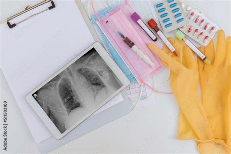 Electrocardiogram Of Wave In Paper Report With Pacemaker And Chest X Ray Digital Tablet View In