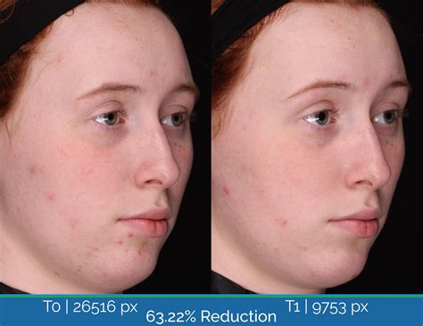 Lead Collection Landing Page Validated Claim Support