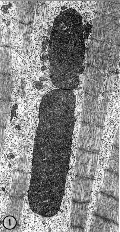 Two Interfibrillar Megamitochondria Note Adjacent Mitochondria Of Download Scientific Diagram