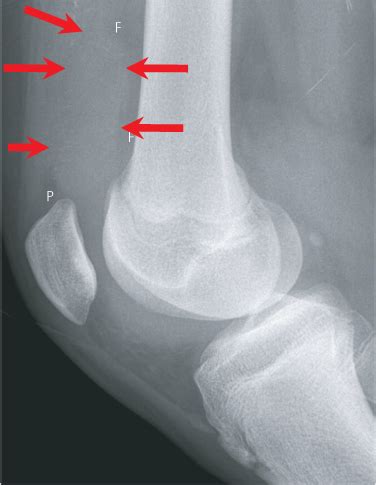 Knee Radiology Key