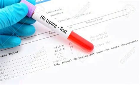 What Is Hba2 Blood Test Hemoglobin A2 Pacer Federation