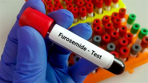 Furosemide Dosis Manfaat Dan Efek Sampingnya Primaya Hospital