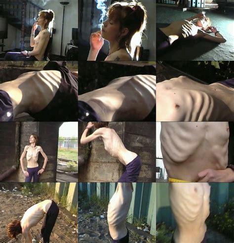 Horrors Of The 21st Century Anorexia Skin And Bone Page 3