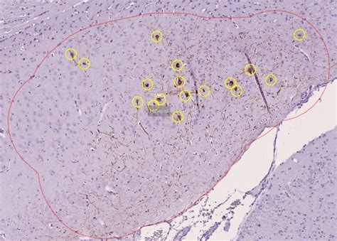 Trouble Using Pixel Classifier Applied To Annotations Image Analysis Imagesc Forum
