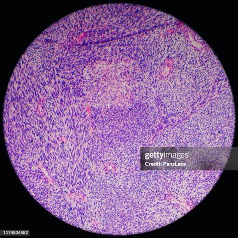 Bacteria Under The Microscope Photos And Premium High Res Pictures